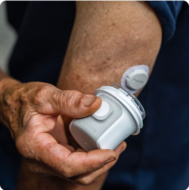 CMPP Dexcom Information | Costco